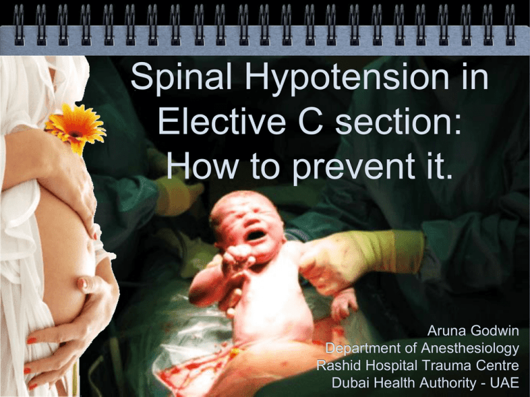 Case 1 Elective C Section Case 1 Elective C Section