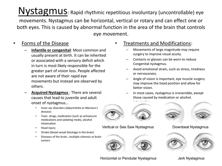 Nystagmus