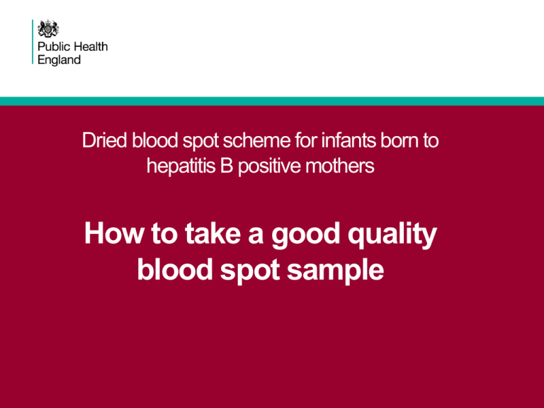 How to take a good quality blood spot sample (PowerPoint