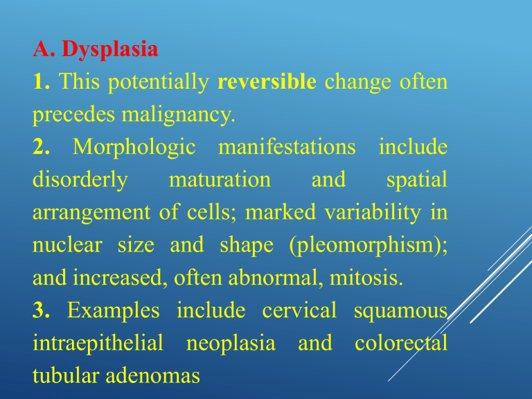 Dysplasia & Neoplasms: Pathology Presentation