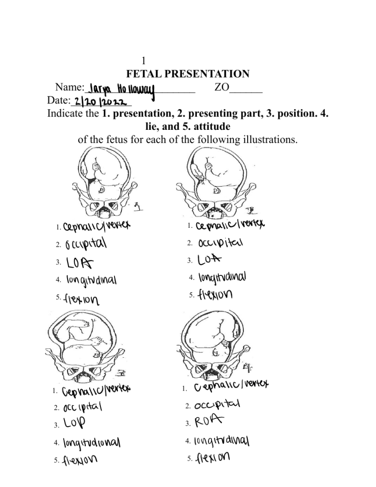 FETAL PRESENTATION ASSIGNMENT FETAL PRESENTATION ASSIGNMENT