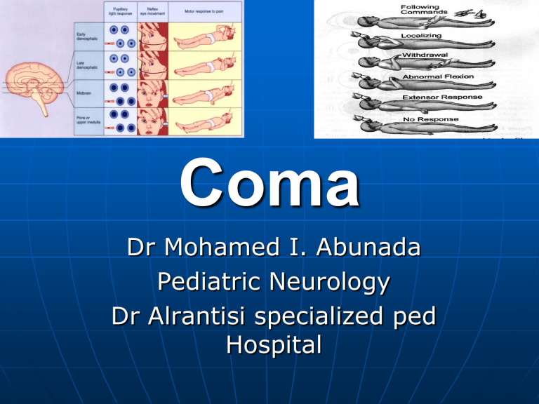 Coma: Definitions, Causes, and Assessment