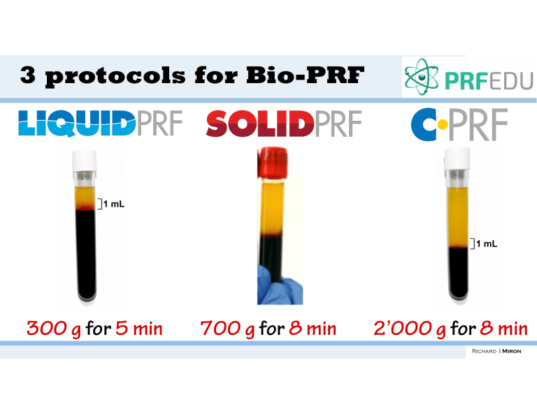 Bio-PRF Protocols: Centrifugation Guide