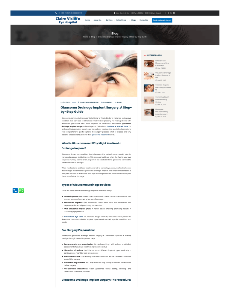 Glaucoma Drainage Implant Surgery: A Step-by-Step Guide