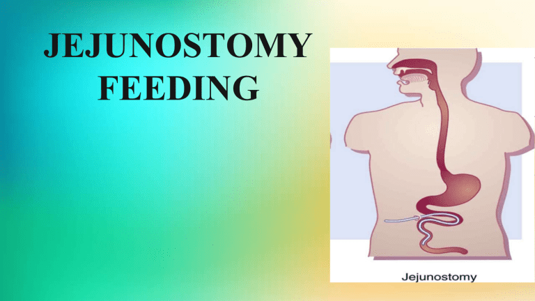 Jejunostomy Feeding: Procedure, Types, Indications & Care