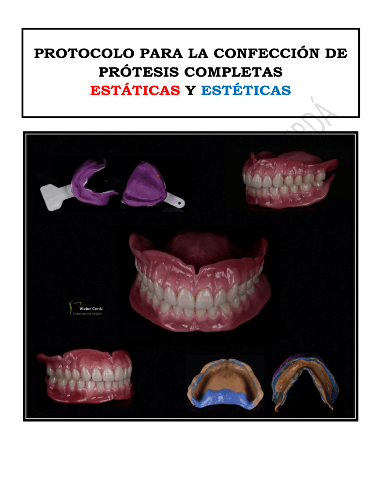 PROTOCOLO protesis COMPLETAS