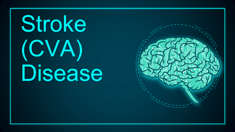 Stroke (CVA) Diagnosis & Management: A Clinical Presentation