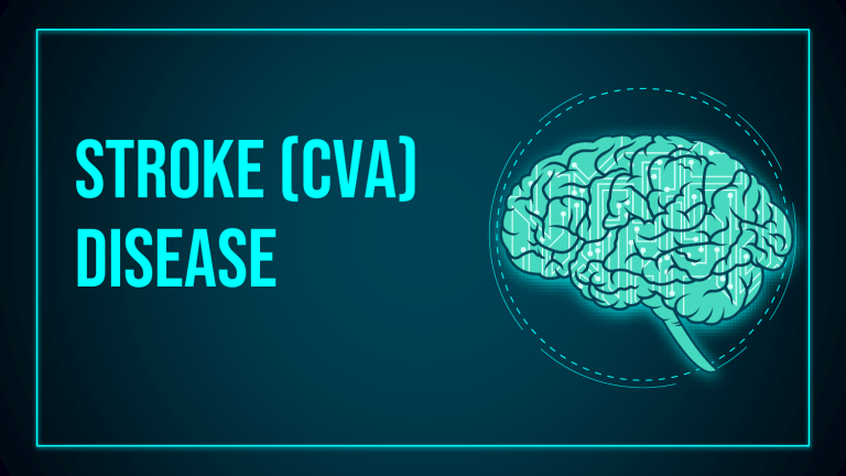 Stroke (CVA) Management: A Clinical Presentation & Guidelines