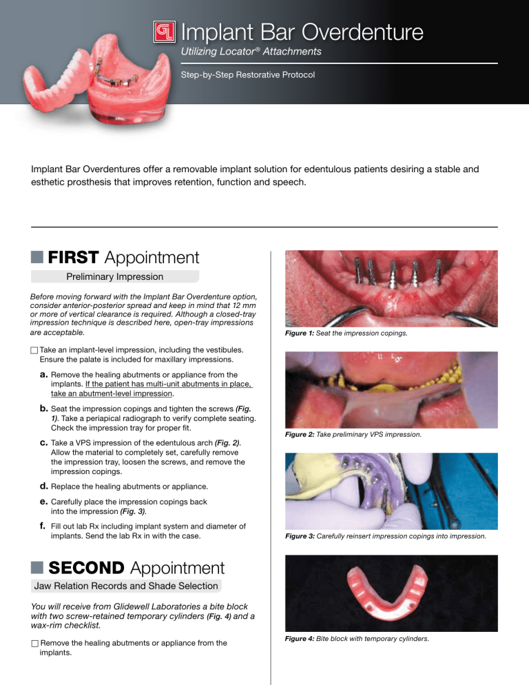 Implant Bar Overdenture: Step-by-Step Restorative Protocol
