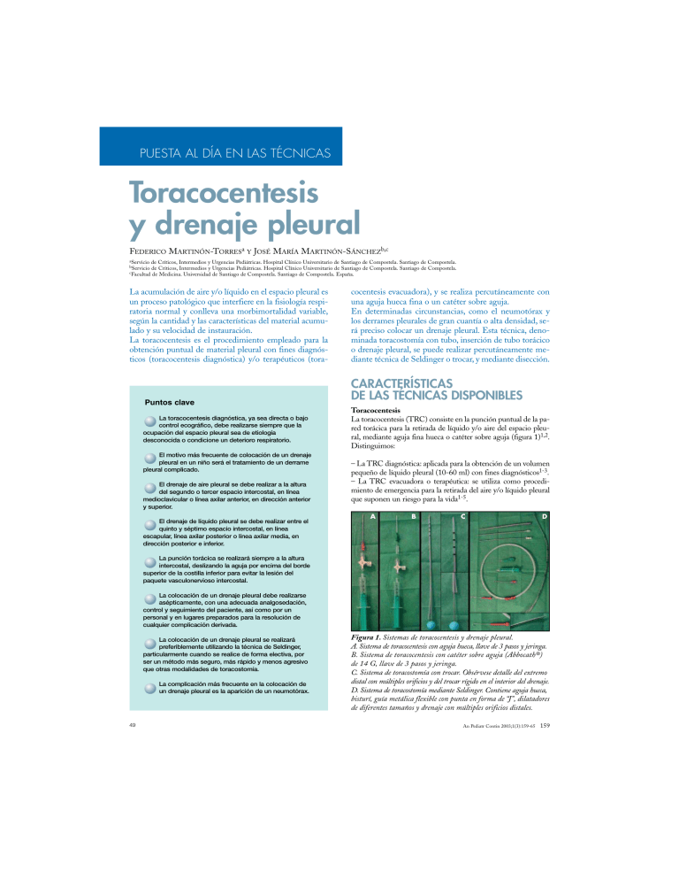 Técnicas de Toracocentesis y Drenaje Pleural
