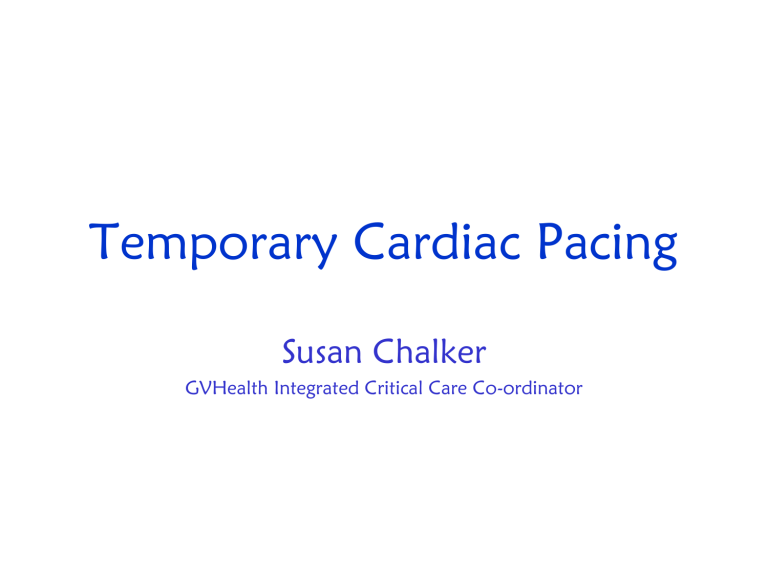 Temporary Cardiac Pacing: Types, Management & Troubleshooting Guide