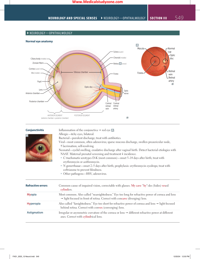 Neurology & Ophthalmology: Eye Anatomy & Disorders