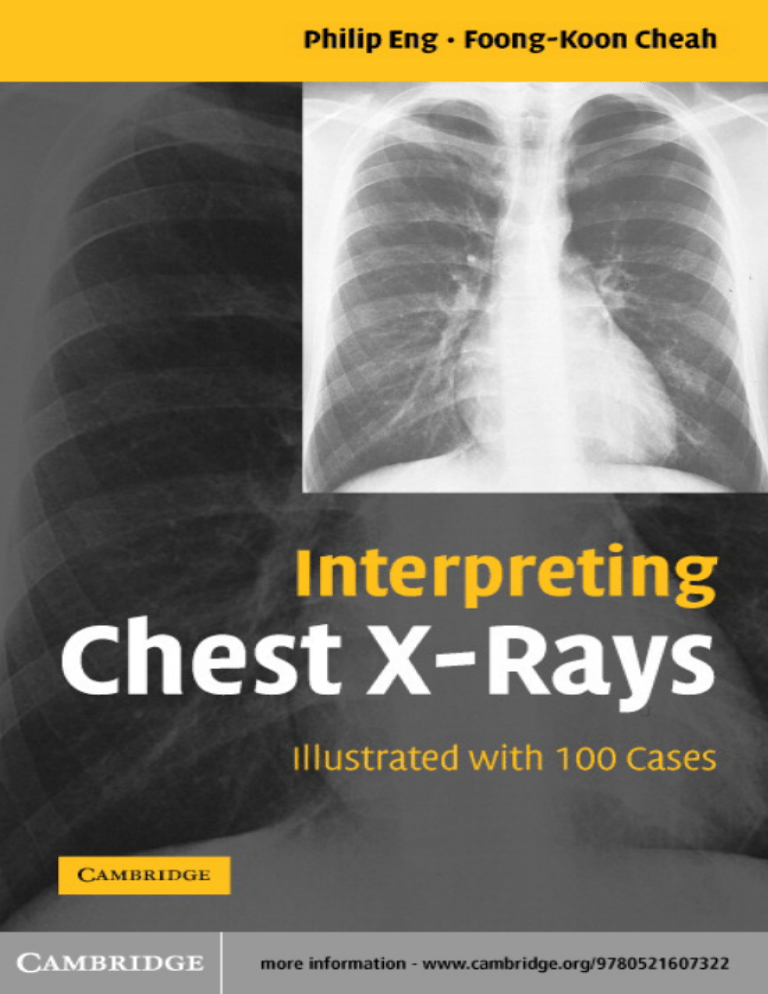 Interpreting Chest X-Rays: 100 Illustrated Medical Cases for Doctors