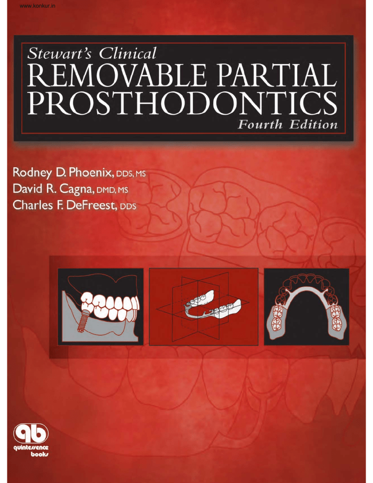 Removable Partial Prosthodontics: Clinical Textbook