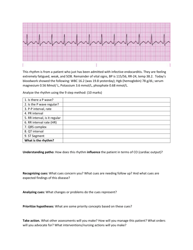 ECG Rhythm Analysis & Endocarditis Patient Case Study