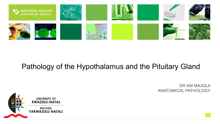 Pathology of Hypothalamus & Pituitary Gland: Adenomas & Disorders