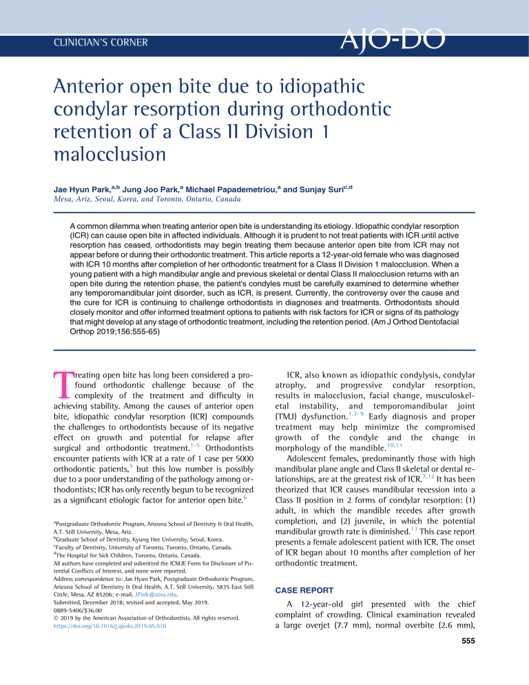 Anterior Open Bite & Idiopathic Condylar Resorption: Orthodontic Case Study