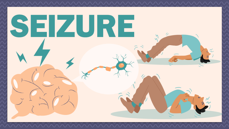 What is a Seizure? Types and First Aid