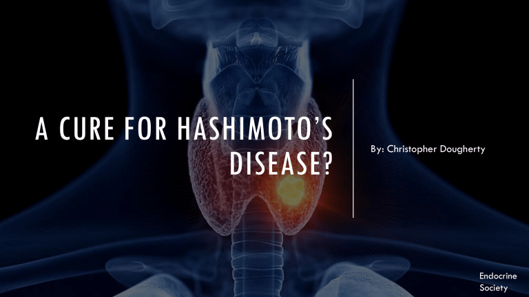 A Cure for Hashimoto's? Genetic & Ethical Analysis