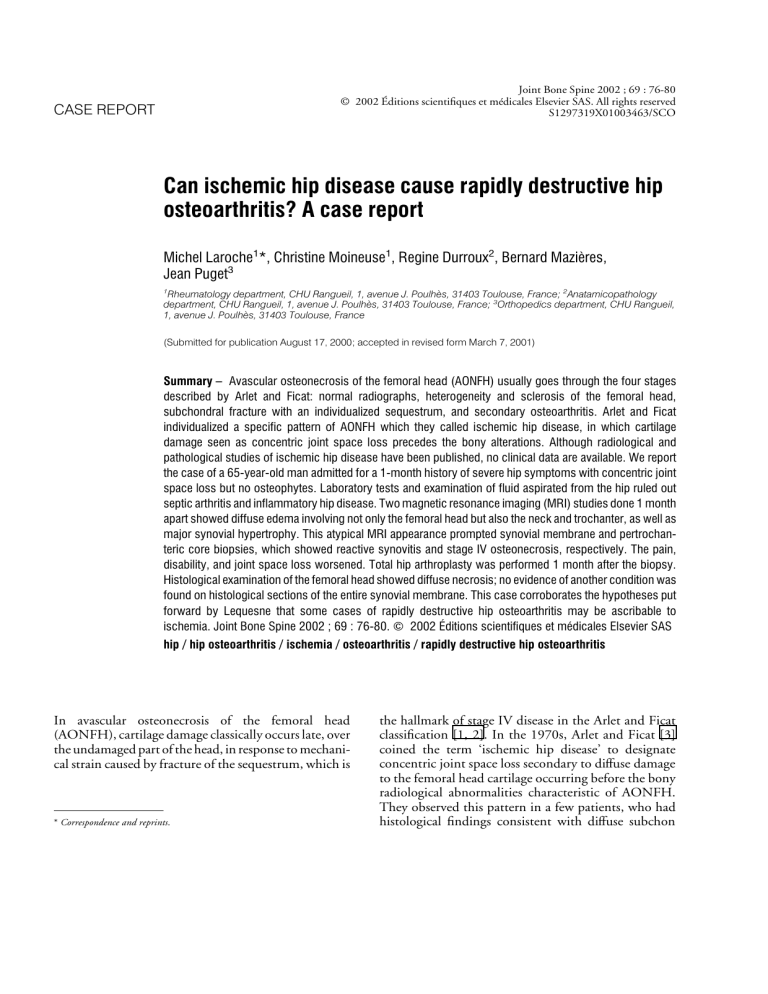 Ischemic Hip Disease & Rapid Osteoarthritis