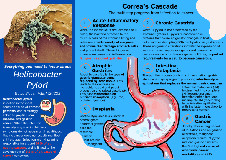 H. pylori to Gastric Cancer: Correa's Cascade